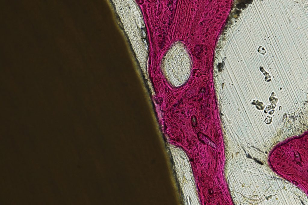 Bone-Implant Interface – Orthopedic Research Laboratory