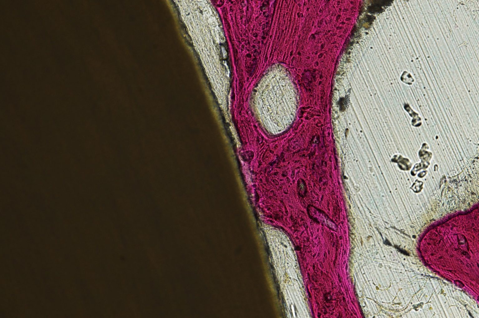 Bone-Implant Interface – Orthopedic Research Laboratory