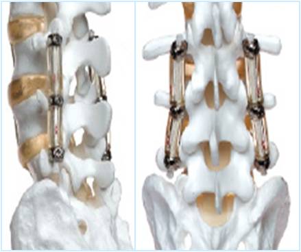 Biological Modeling – Orthopedic Research Laboratory