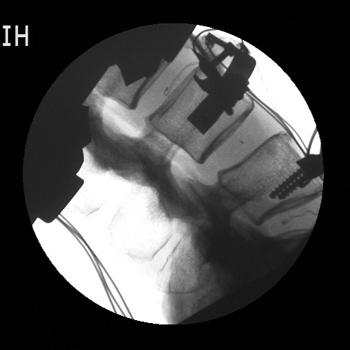 The Radiography Laboratory – Orthopedic Research Laboratory