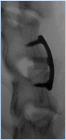 Biological Modeling – Orthopedic Research Laboratory